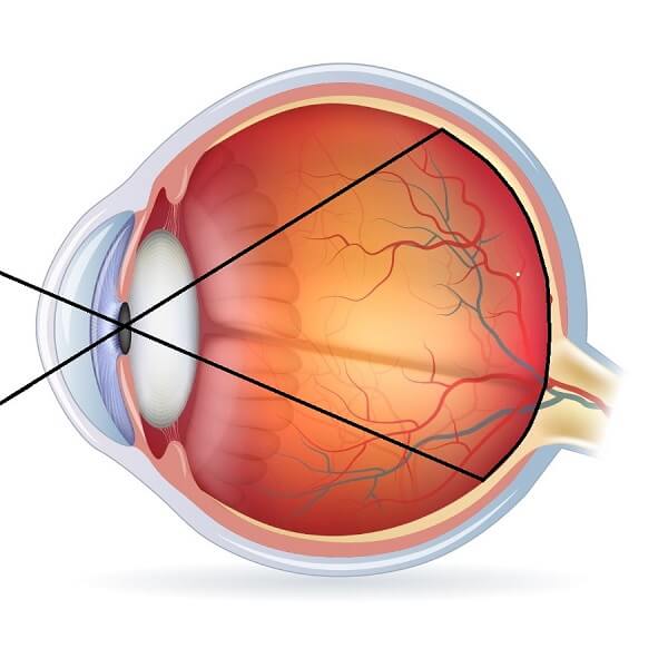 20D Lens | OICO | oico.co.uk